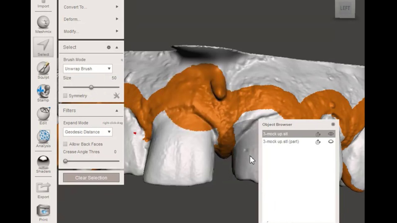 training case : perio guide p1 - YouTube