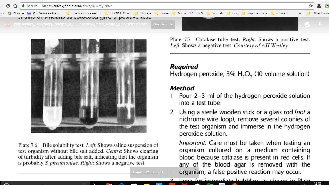 Catalase test (for exams and viva) staphylococcus - YouTube