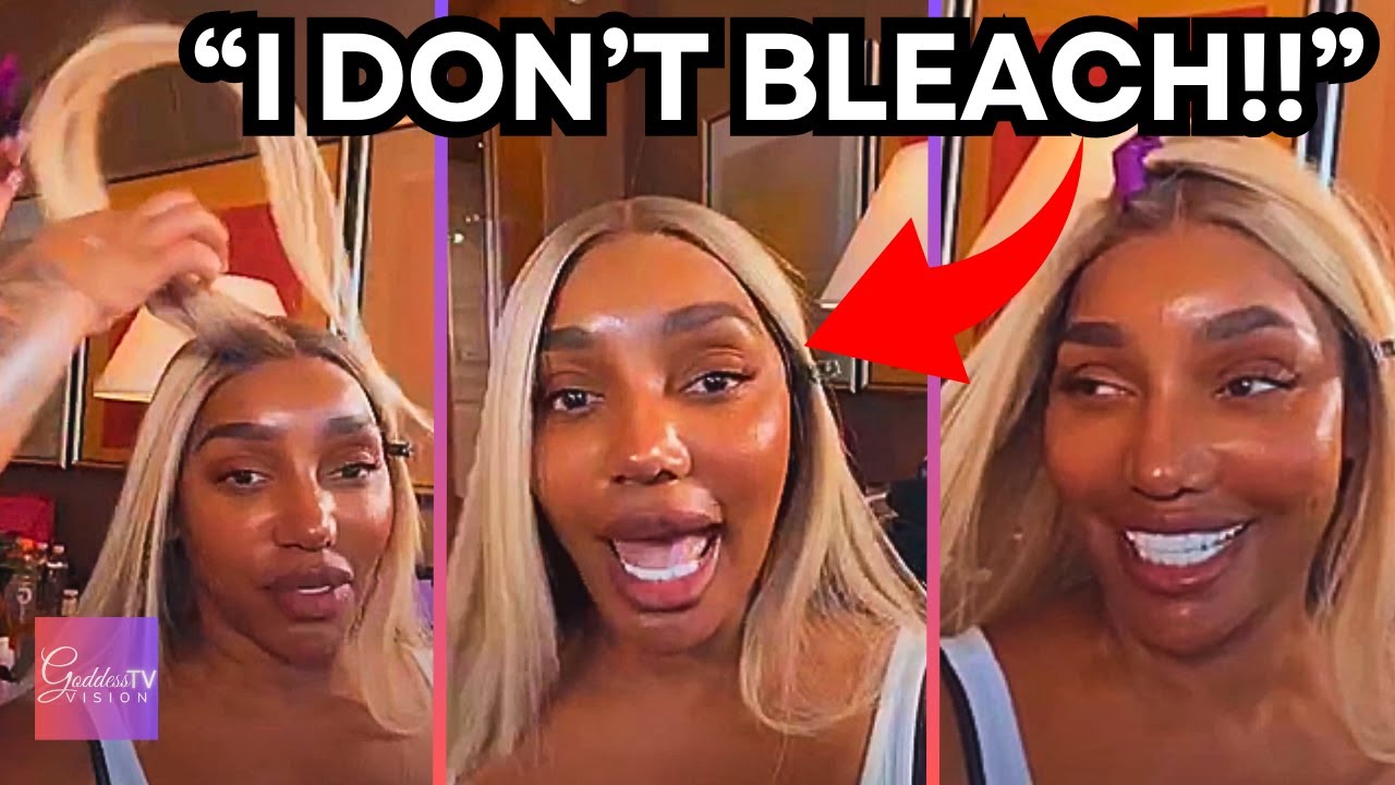 Nene Leakes: REAL TALK🗣️(Bleach!ng & Plastic Surgery Allegations‼️ ...