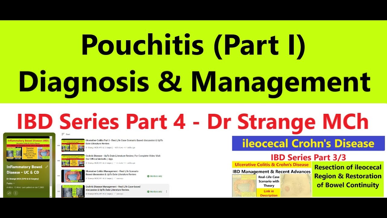 Pouchitis (Part I): Diagnosis and Management for Sx Residents. Part 4 ...