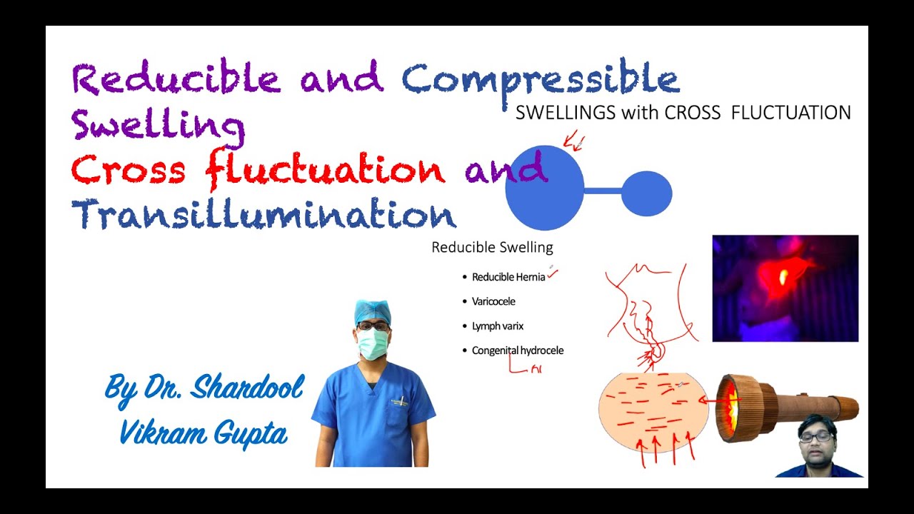 Reducible and Compressible Swelling/ Cross fluctuation and ...