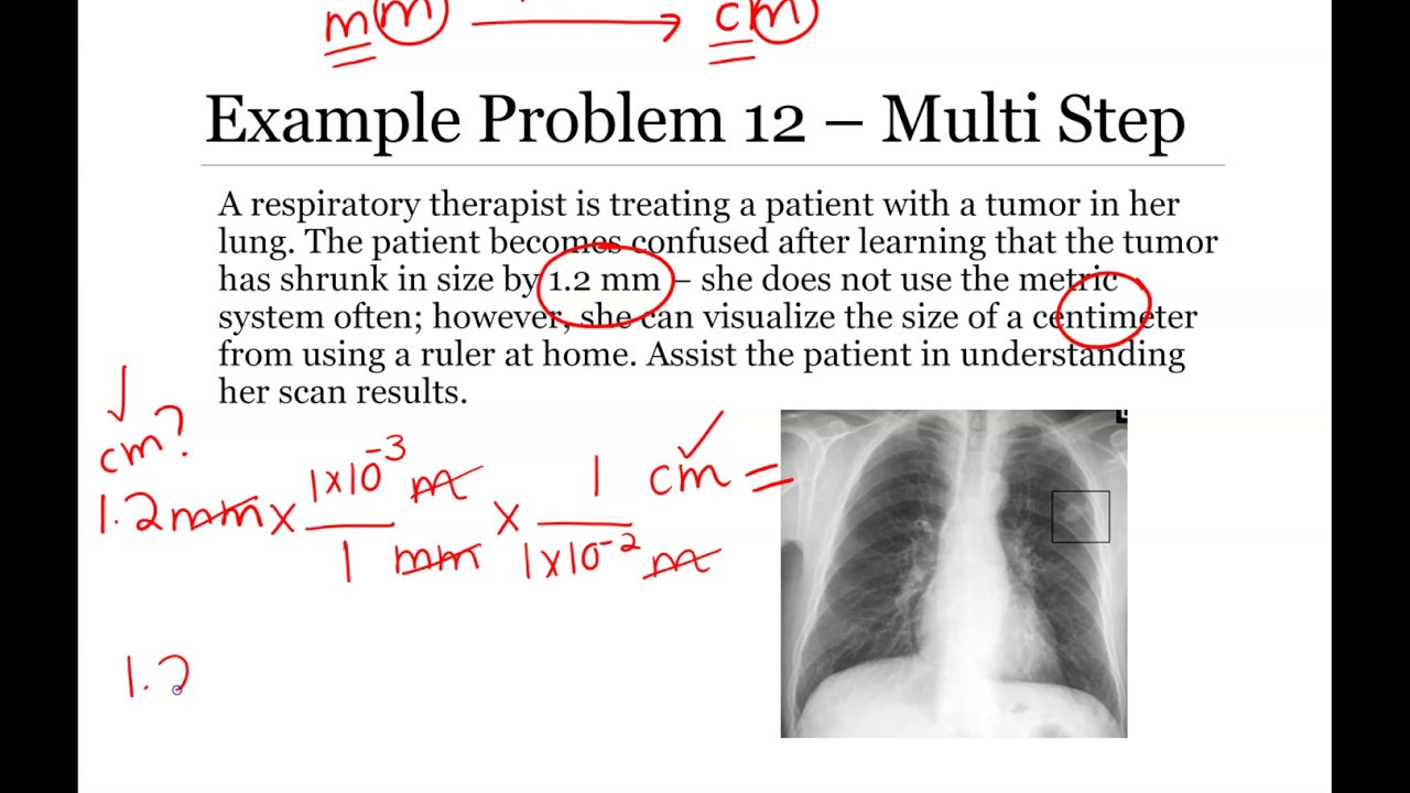 Example Problem 12 - Metric System - YouTube