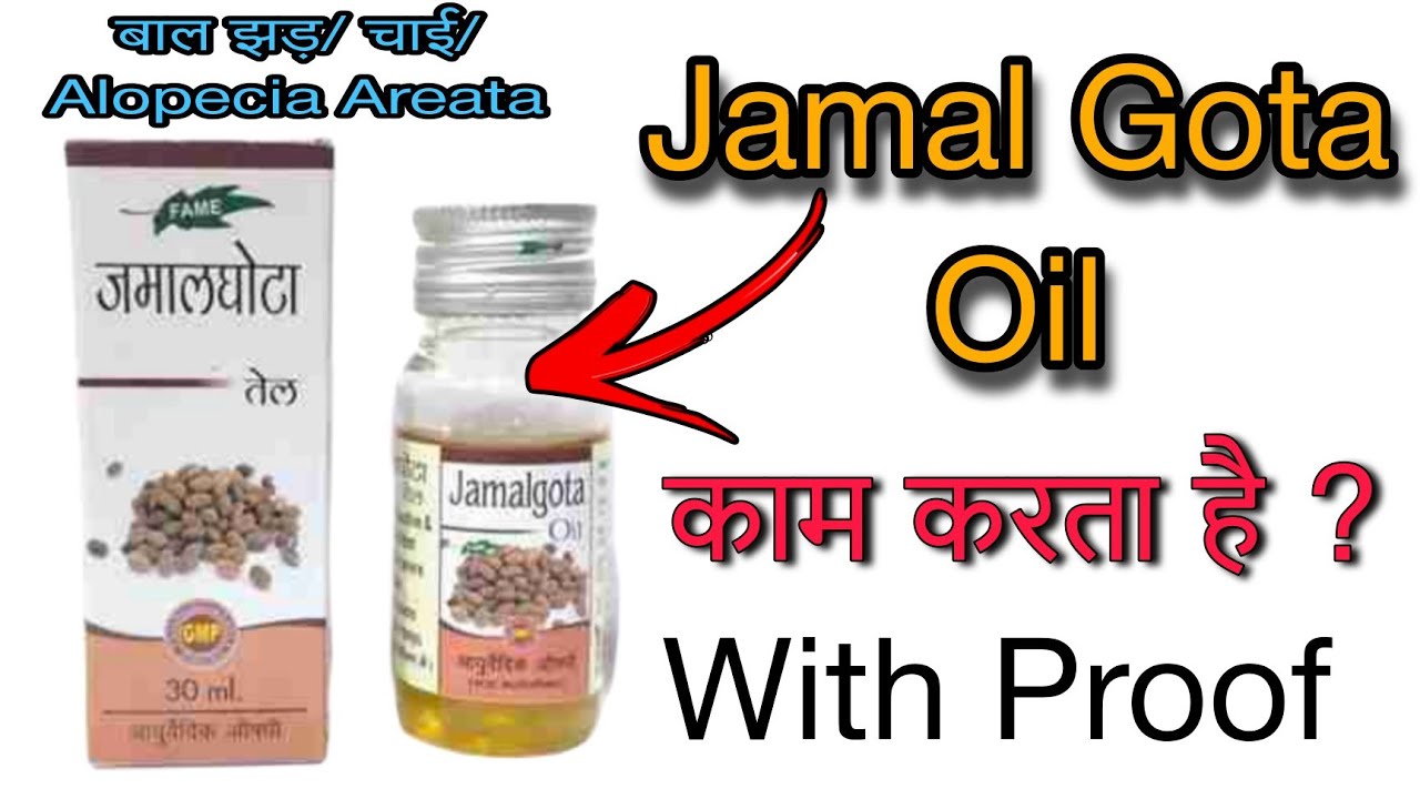 Alopecia Areata / बाल झड़ के लिए Jamal Gota Oil for hair in hindi Karta ...