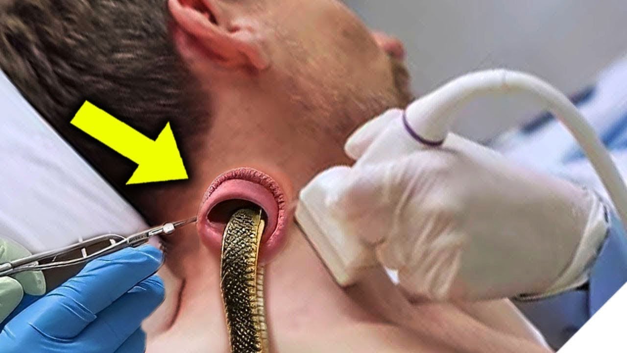 He had a snake stuck around his neck—his wife saw it and instantly ...