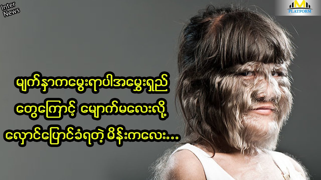 အမွှေးတွေ အများကြီးနဲ့ တကယ့် မျောက်လေးလိုပဲ ချစ်စရာလေးပါ Youtube
