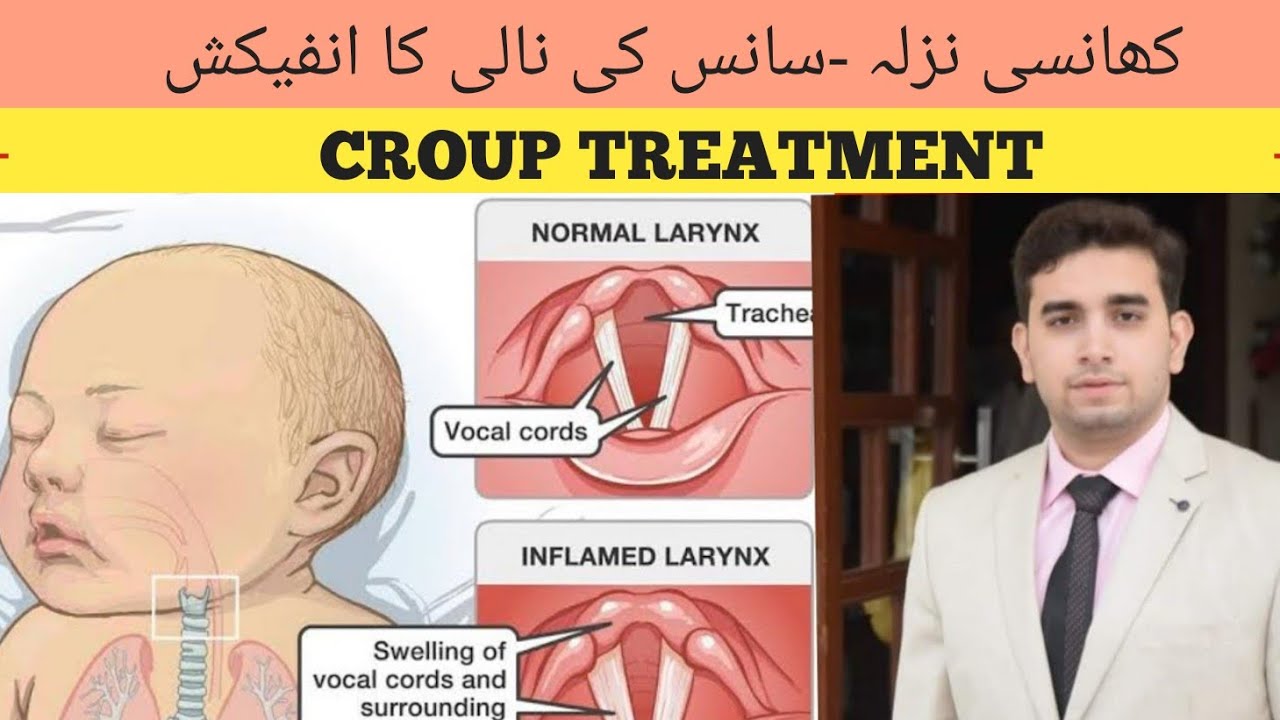 Laryngeotracheobronchitis(CROUP) ITS CAUSES|SIGN& SYMPTOMS|TREATMENT ...