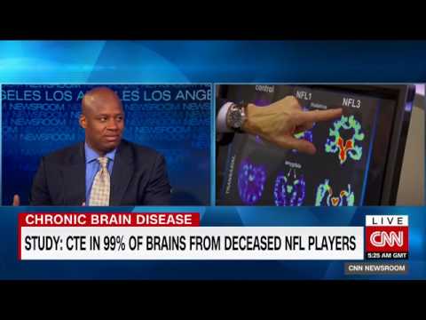 Sports Agent Anthony Tall Discusses the Effects of CTE Study on ...