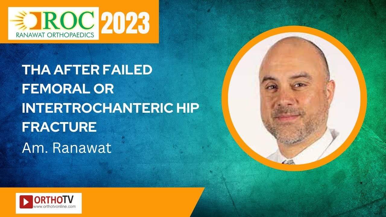 THA After Failed Femoral or Intertrochanteric Hip Fracture - Am ...