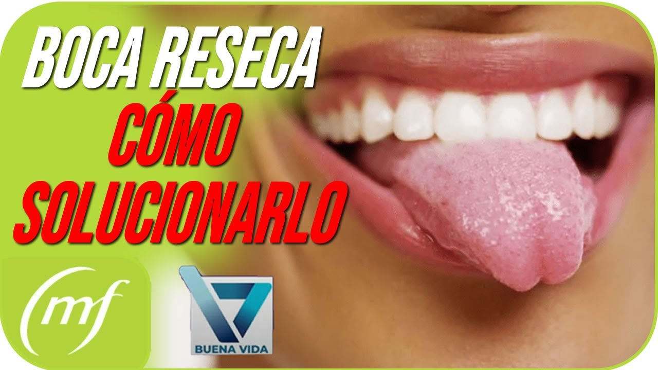 Boca reseca - Cómo solucionarlo - YouTube