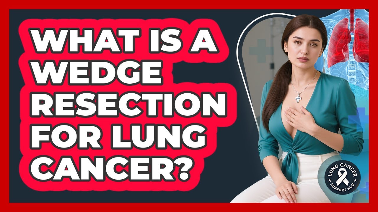 What Is A Wedge Resection For Lung Cancer? - Lung Cancer Support Hub ...