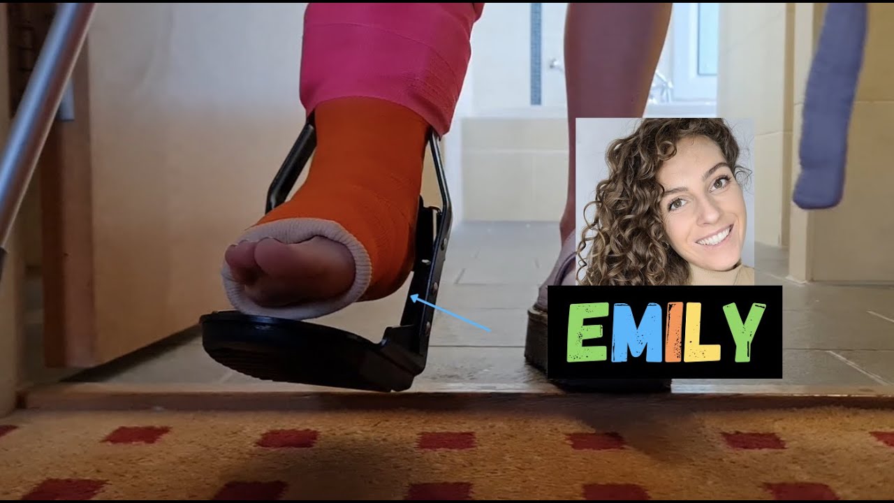 Short Leg Cast - YouTube