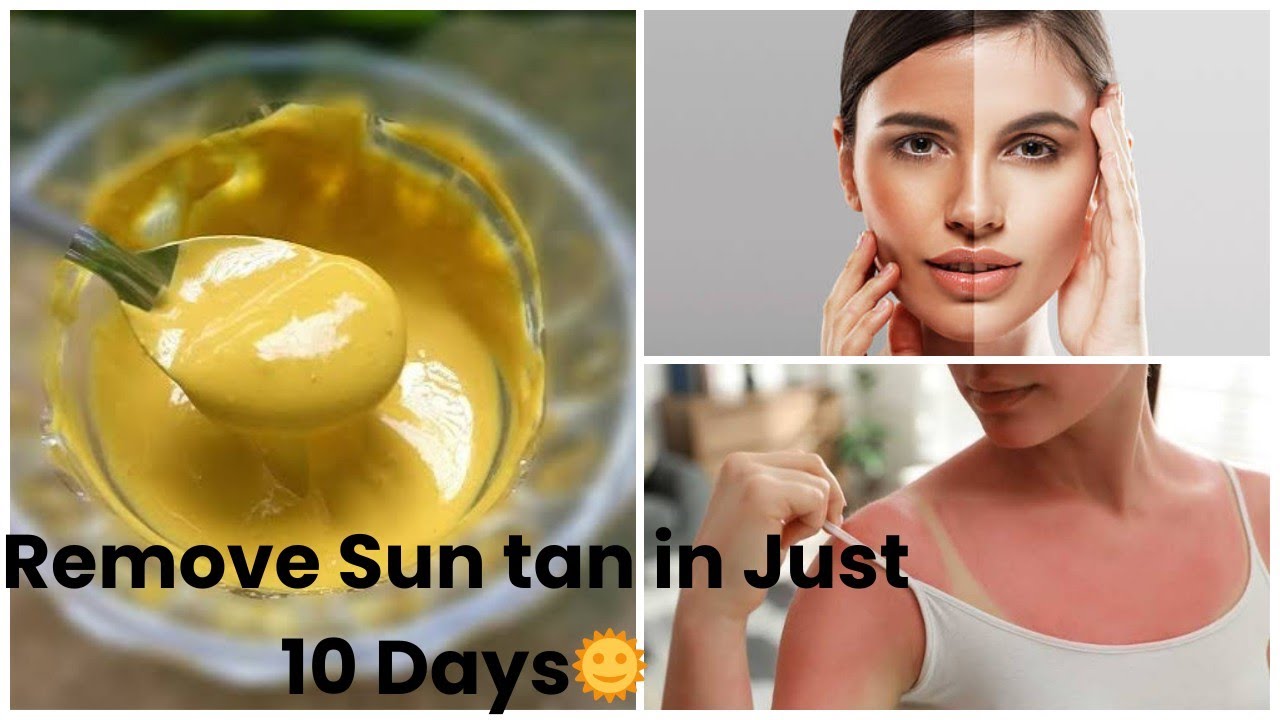 Easy way to Remove Sun Tan in just 10 Days 🌞 || Most Effective Home ...