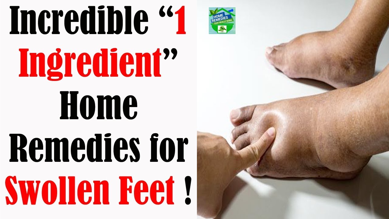 Incredible “1 Ingredient” Home Remedies for Swollen Feet ! - YouTube