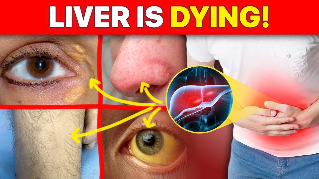 These 8 Things Reveal The State of Your Liver health! - YouTube