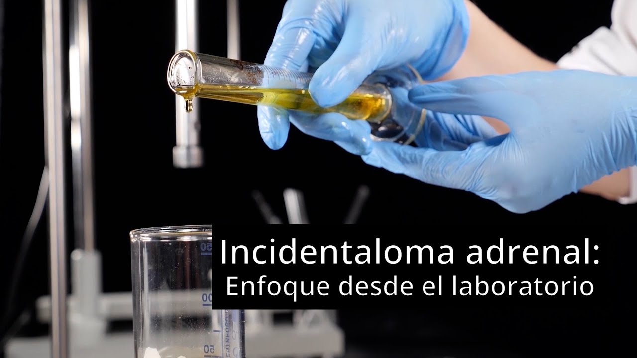 Incidentaloma adrenal enfoque desde el laboratorio - YouTube