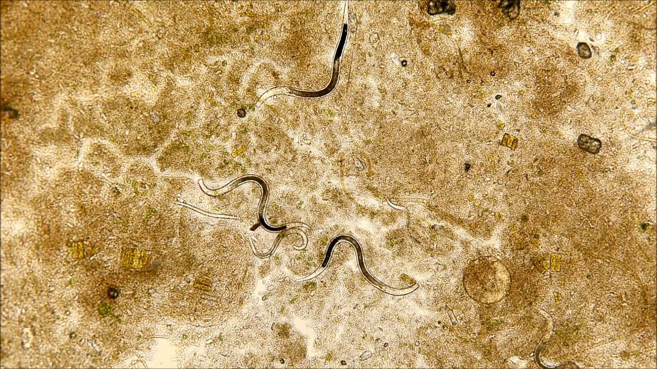 Nematode Worms 100x Microscope - YouTube