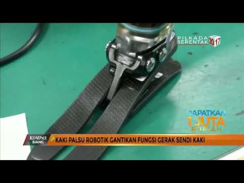 Kaki Palsu Robotik Gantikan Fungsi Gerak Sendi Kaki - YouTube