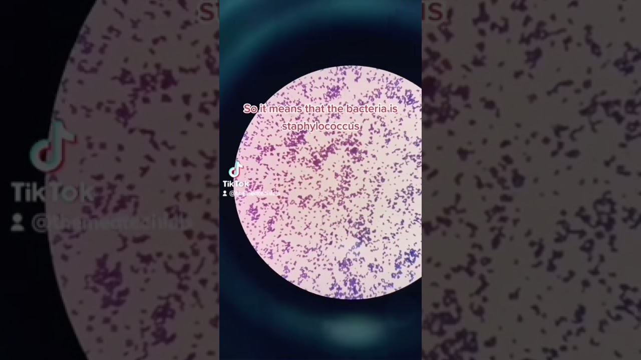 Gram positive cocci identification #bacteria #staphylococcus # ...