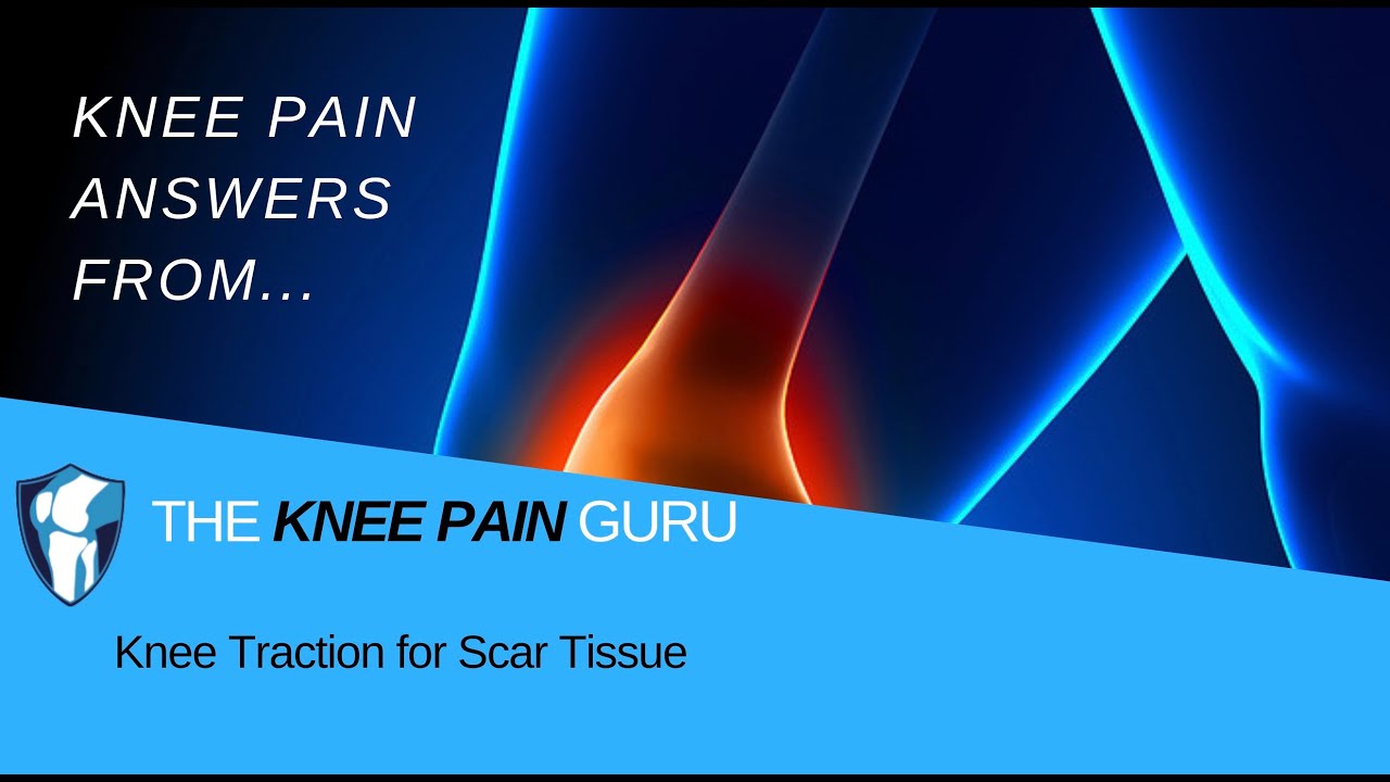 Knee Traction for Breaking Down Scar Tissue by the Knee Pain Guru # ...