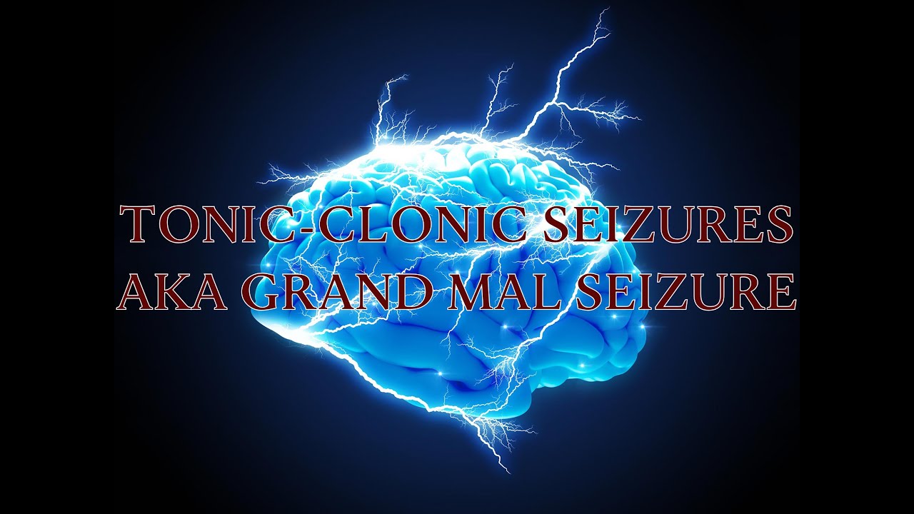 Tonic Clonic Seizures AKA Grand Mal Seizures - YouTube