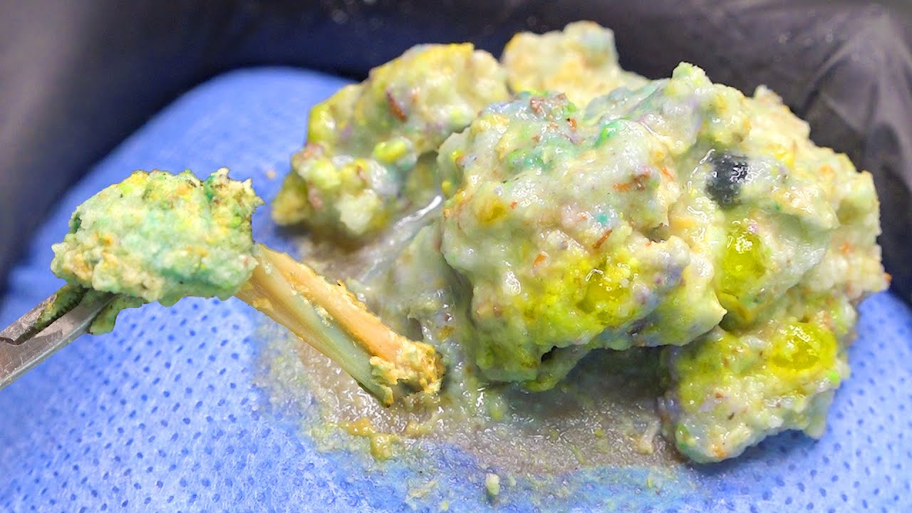 Dr. Lee Geoff Butler Enilsa MrPopZit 😲 Professional pedicure process ...