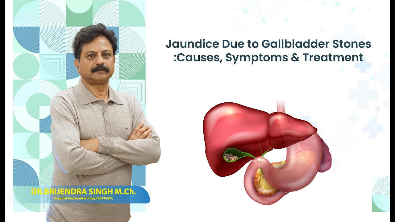 Jaundice Due to Gallstones: Warning Signs & Treatment Options - YouTube