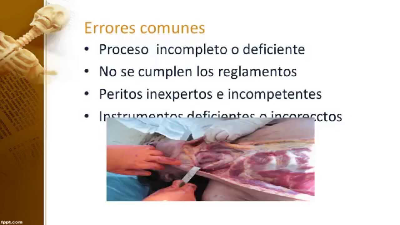 la autopsia medicina legal - YouTube