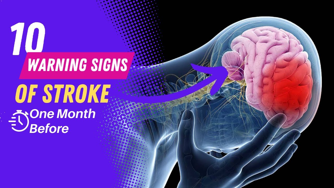 10 Warning Signs Of Stroke One Month Before | You Must Know Them - YouTube