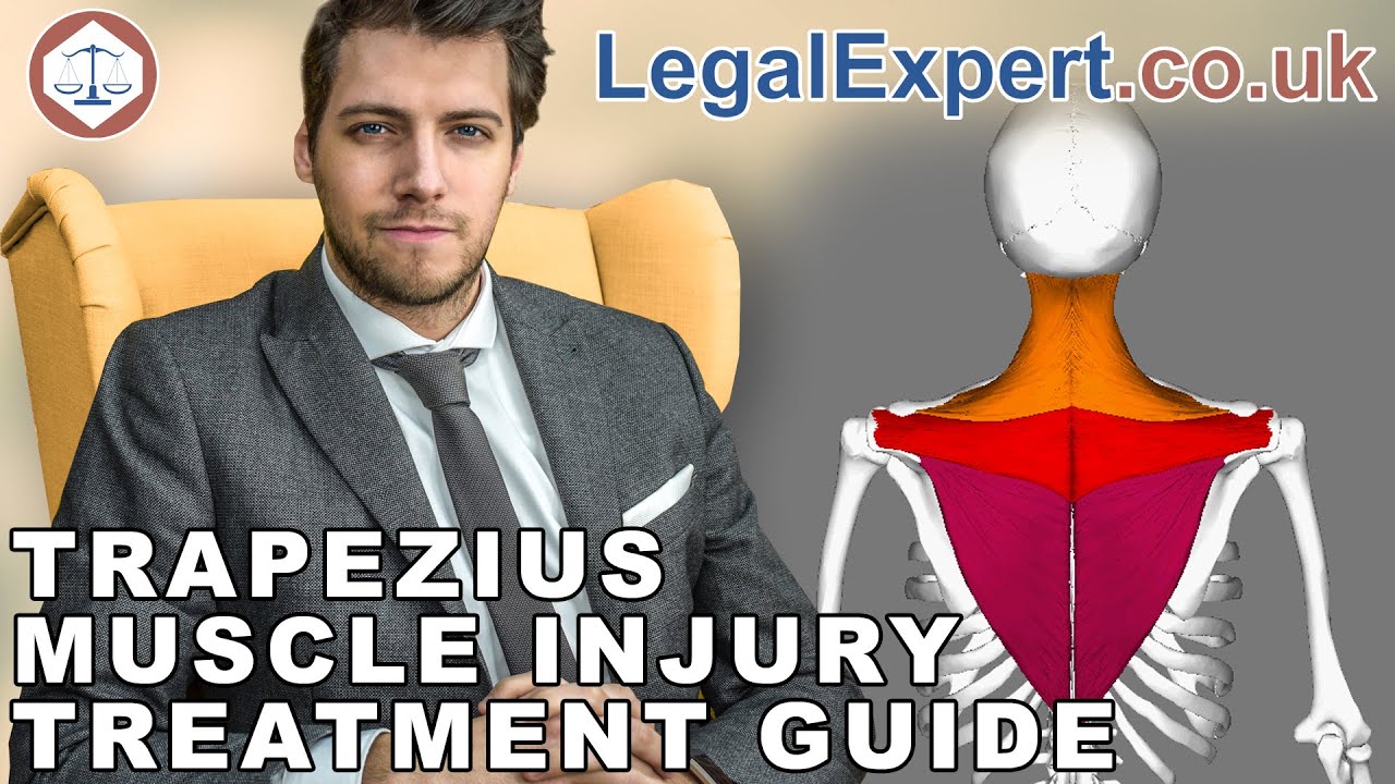 Trapezius Muscle Injury Treatment Guide ( 2019 ) UK - YouTube