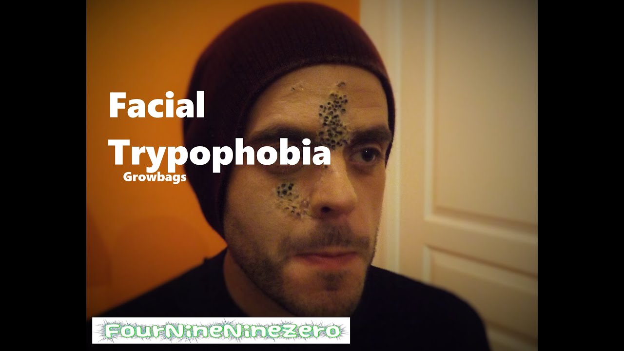 Facial Trypophobia from the forehead down the cheek ...