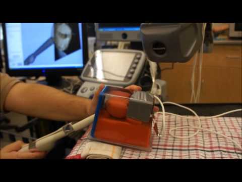 Tracked TRUS imaging for prostate biopsy - YouTube