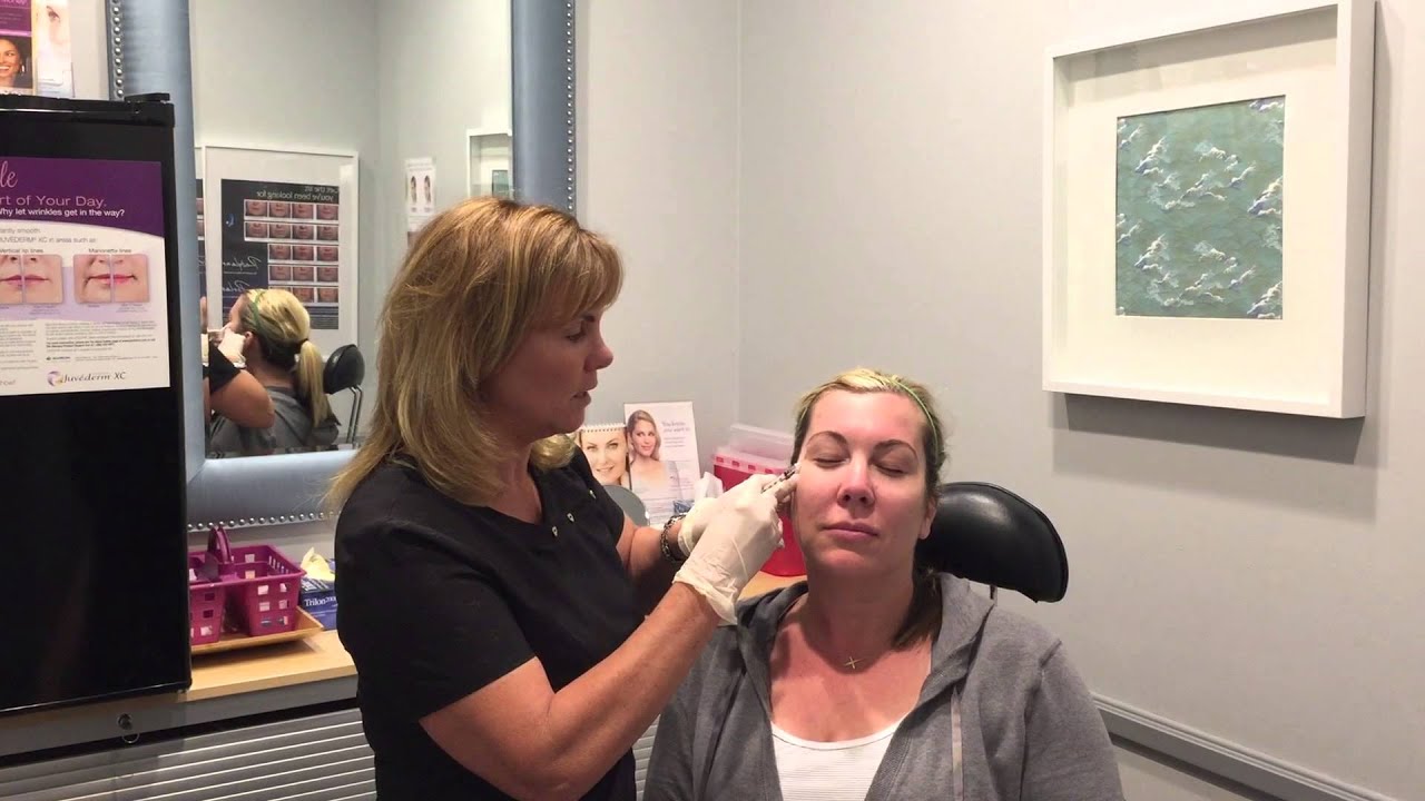 Advanced Botox Treatment Areas - Results May Vary - YouTube