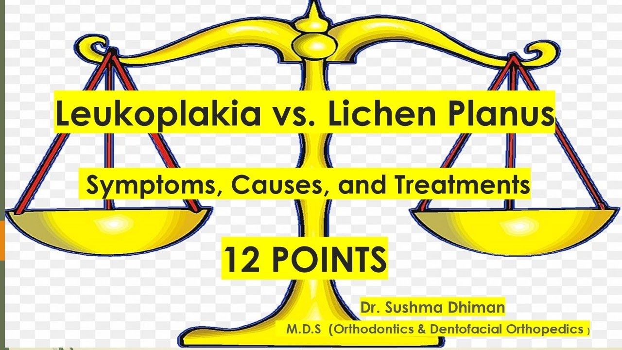 White patches of mouth#Oral Leukoplakia vs Lichen Planus# - YouTube