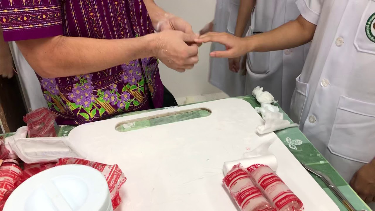 Buddy finger splint - YouTube