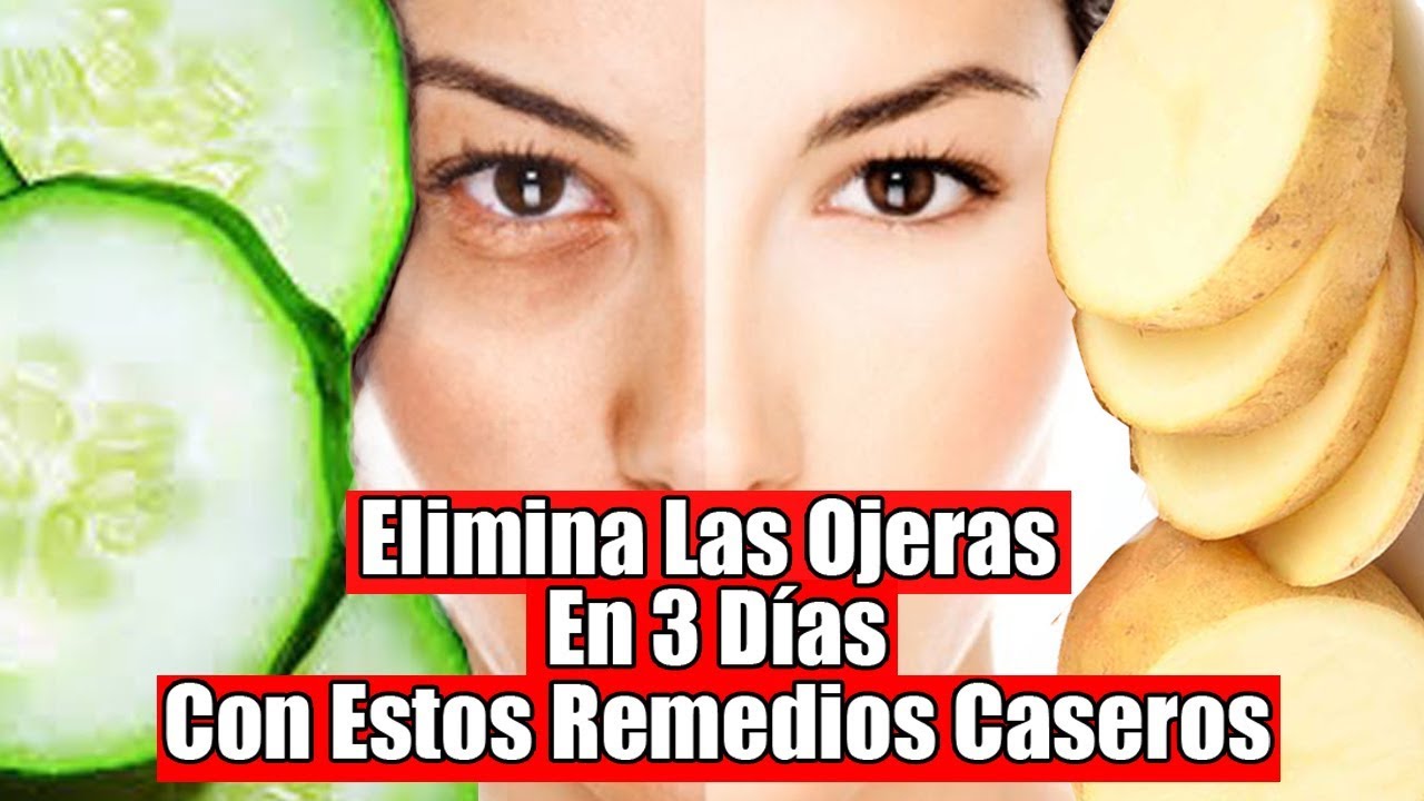 Elimina Las Ojeras En 3 Días Con Estos Remedios Caseros - YouTube