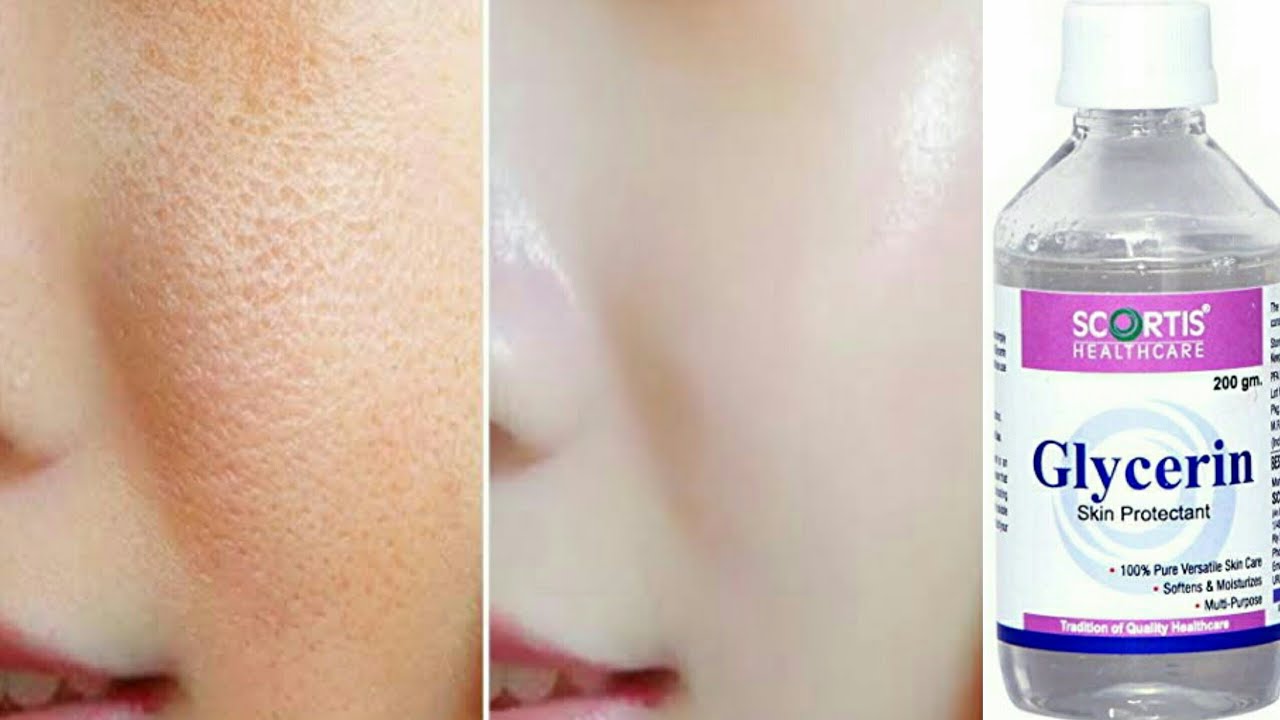 GLYCERINE, GLYCERINE FOR FACE, APPLY GLYCERINE FOR SKIN, CAN WE APPLY ...