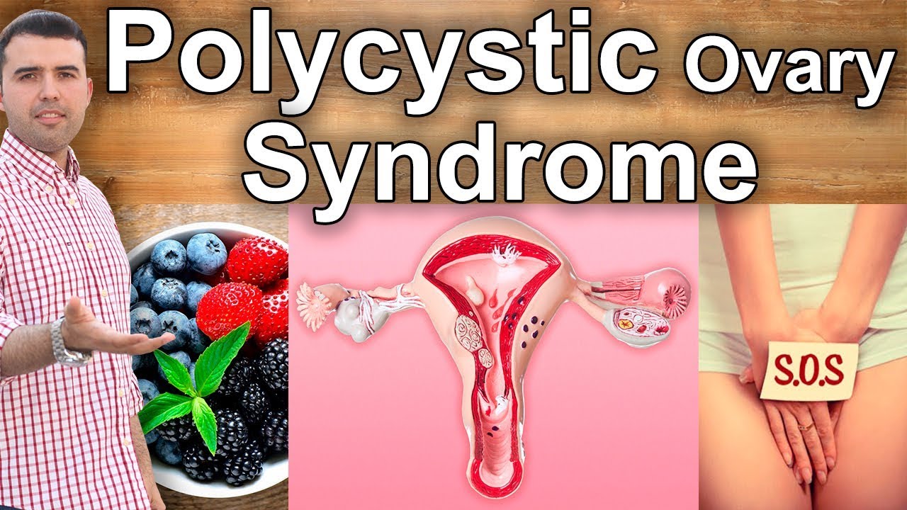 Pcos Natural Treatment How To Cure Ovarian Cysts With Home Remedies