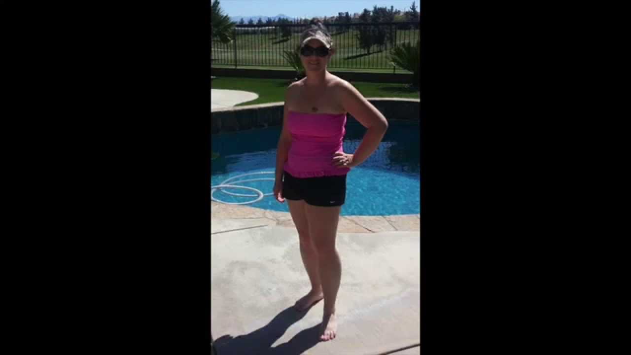 Dr. John Yadegar: Jessica's Weight Loss Surgery & Plastic Surgery ...