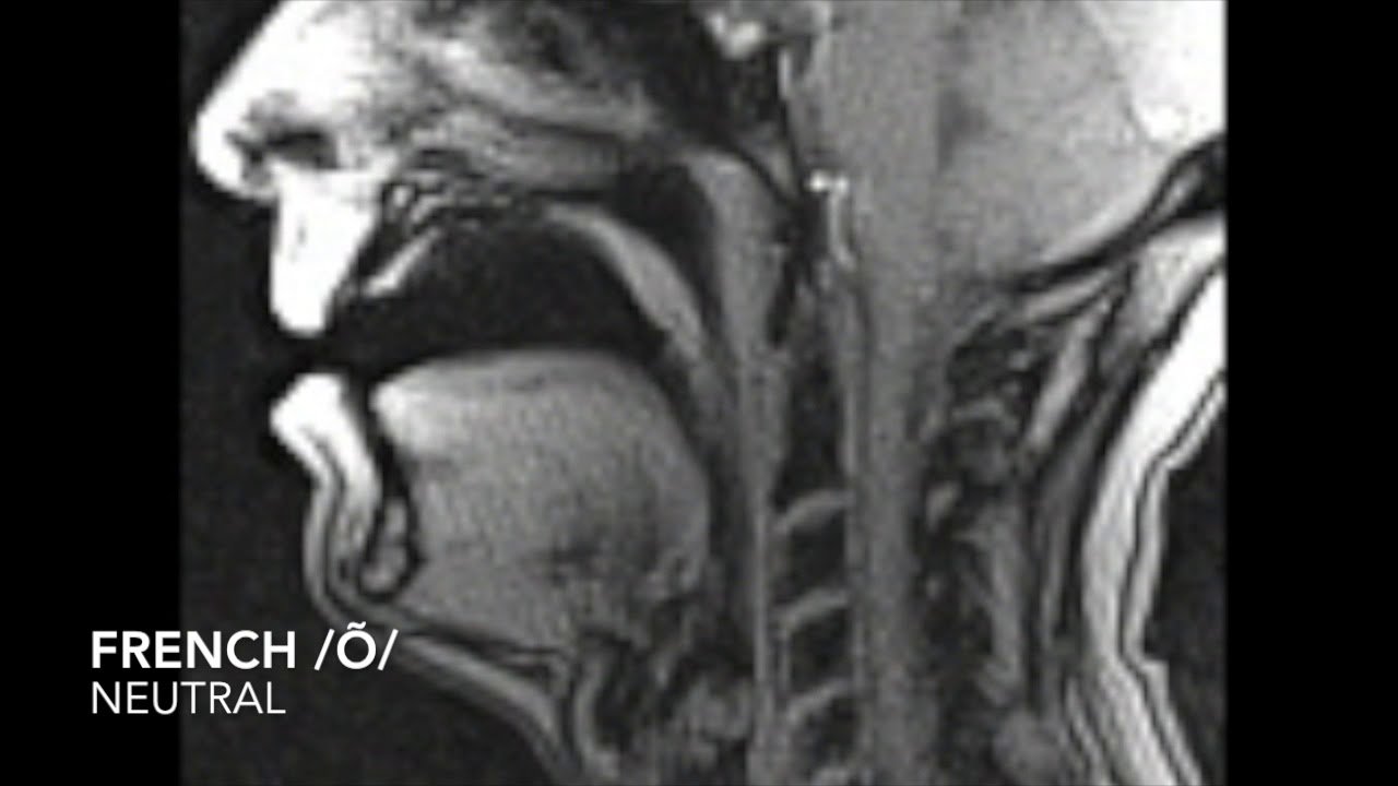 MRI Video of Soft Palate Movement - YouTube