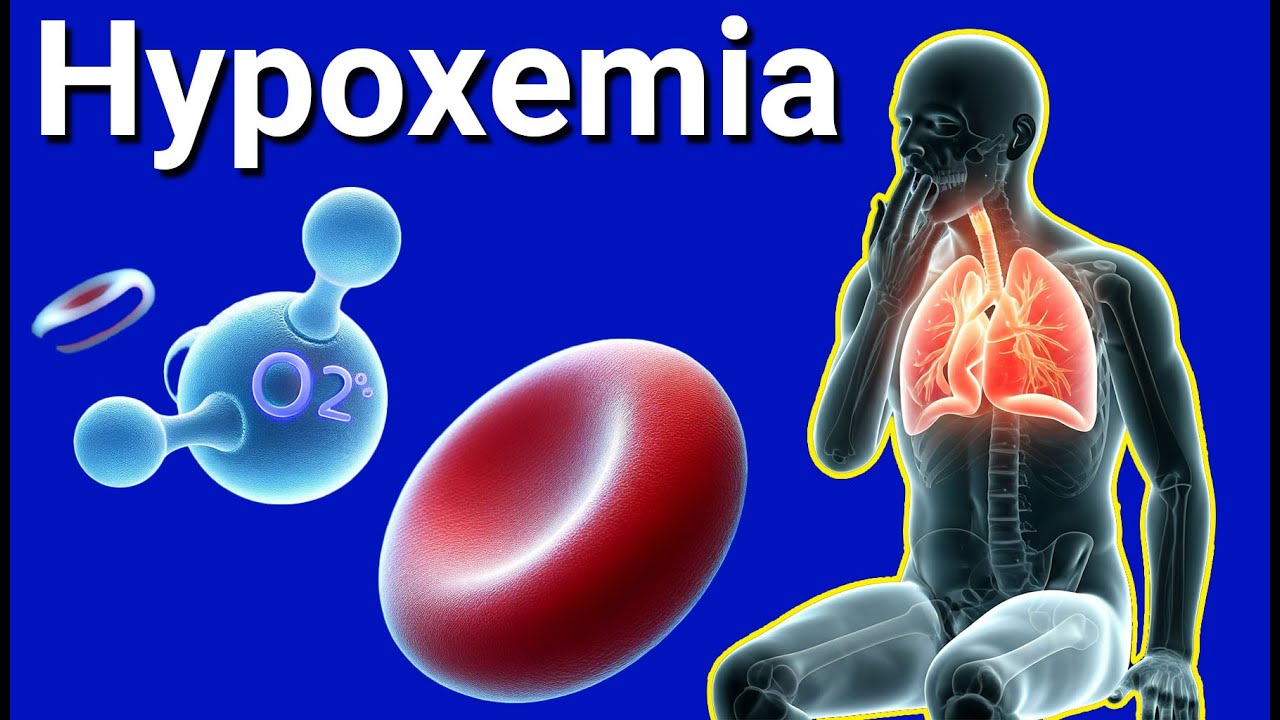 7 Hidden signs of Hypoxemia (Low Bloos Oxigen) - YouTube