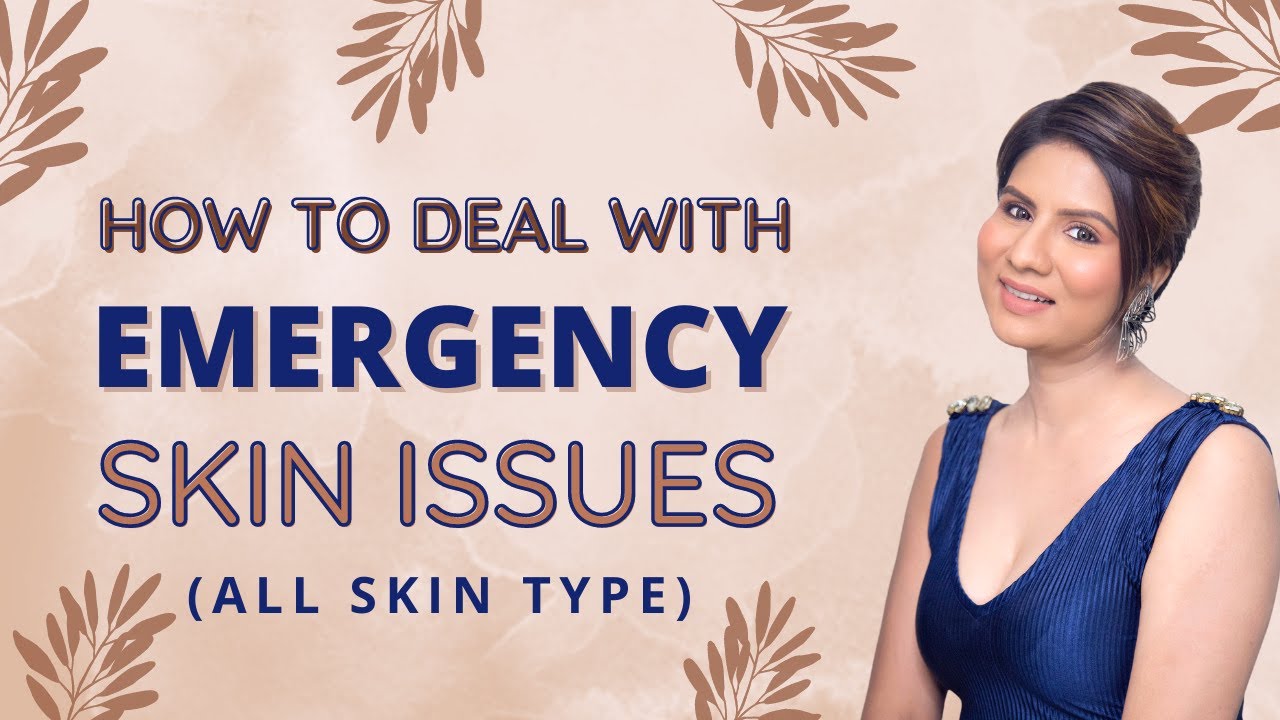 How To Deal With Emergency Skin Issues | Tips, Tricks & Hacks | By ...