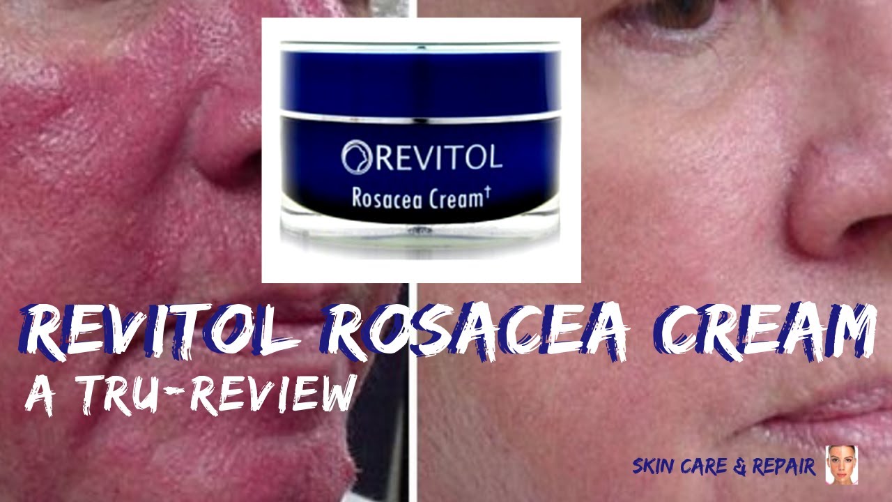 Revitol Rosacea Cream Review : Fast Effective Home Treatment & Remedy ...