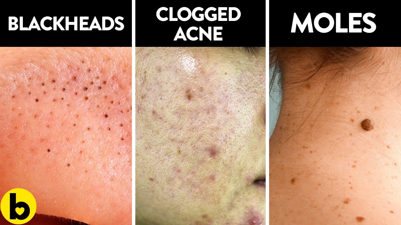 8 Serious Diseases That Are Signaled By Our Skin - YouTube