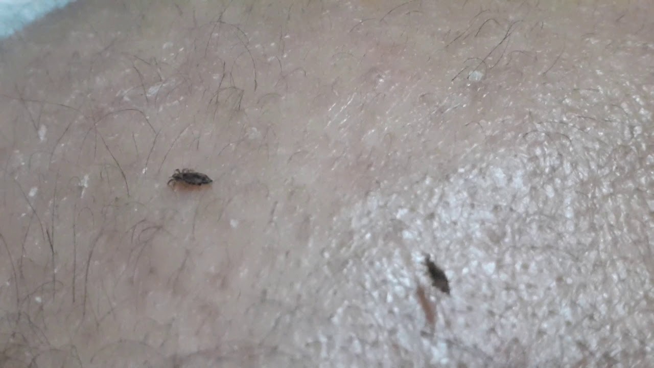 Ang pagiibigan ng mga kuto sa ulo ni joel - YouTube