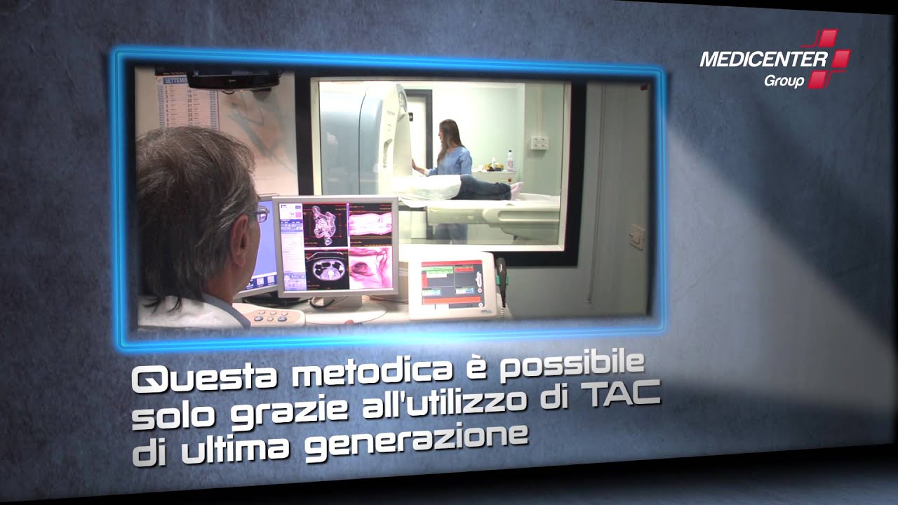COLONSCOPIA VIRTUALE - MEDICENTER GROUP - YouTube