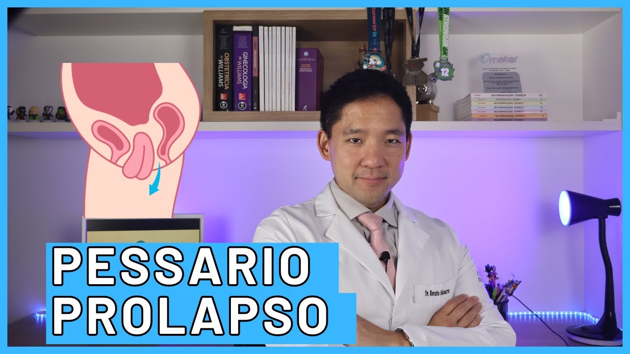 PESSARIO PARA PROLAPSO GENITAL: 7 COISAS QUE TODA MULHER DEVE SABER ...