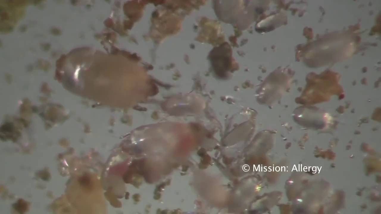 Tungau Debu - YouTube