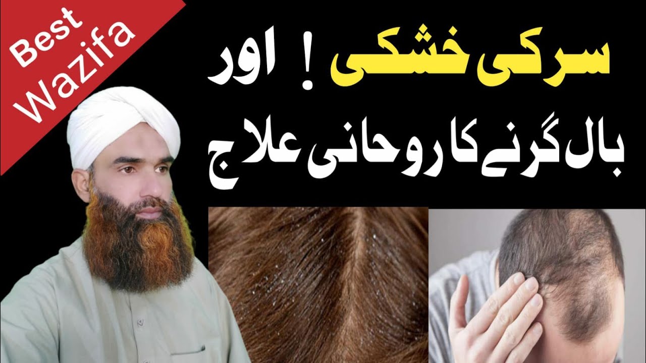 Baal Girne ka Wazifa | Ganjapan ka ilaj | how to stop hair fall wazifa ...