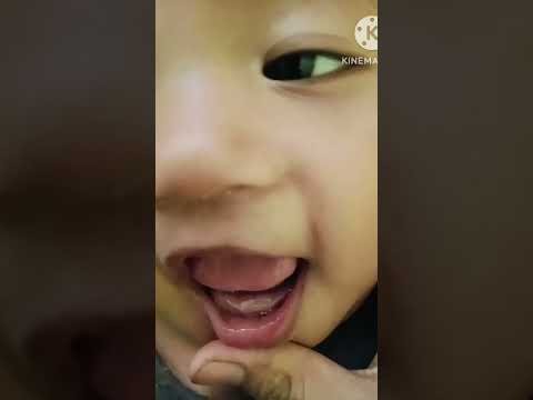 finally meri toshika ka teeth nikal gyi hai☺️#minivlog - YouTube