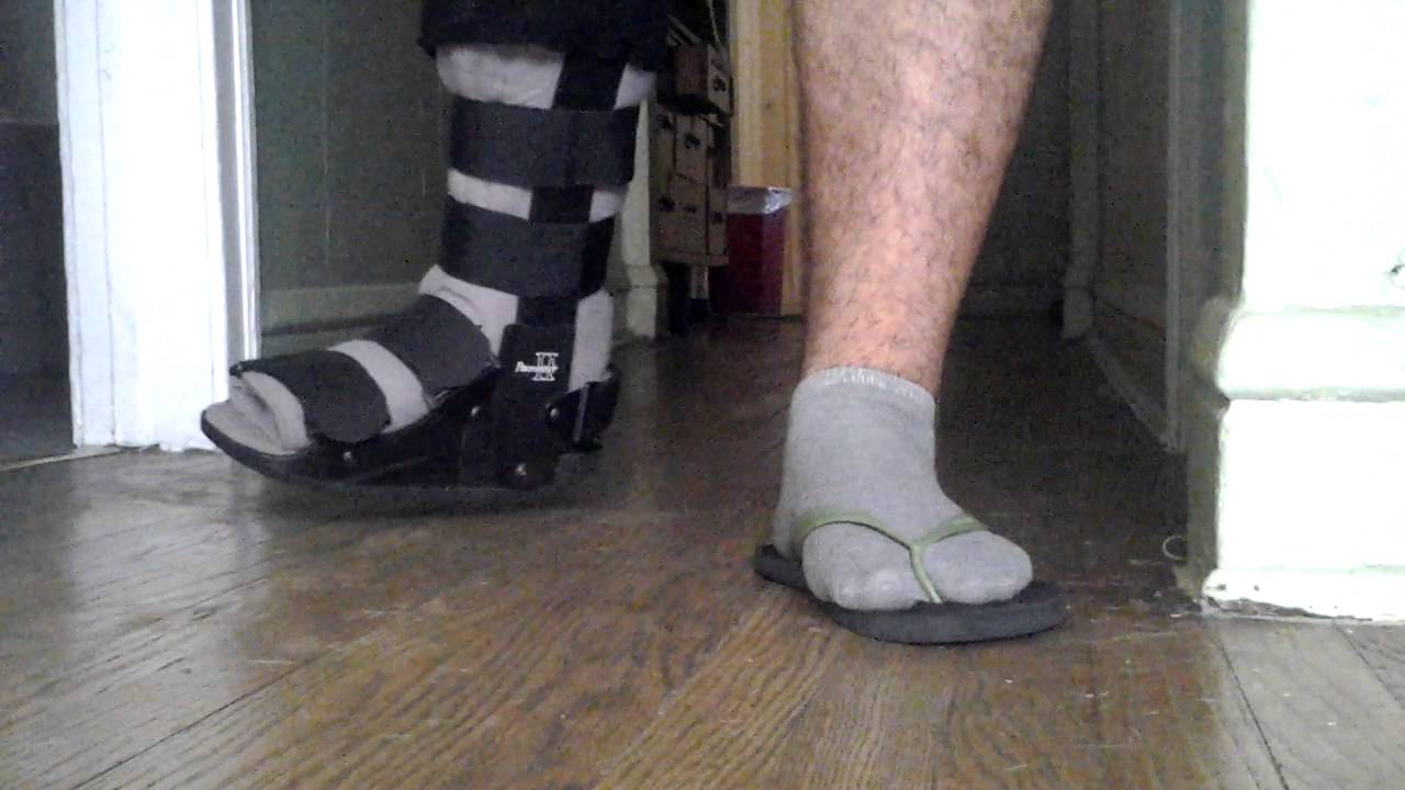 Soft leg cast - YouTube